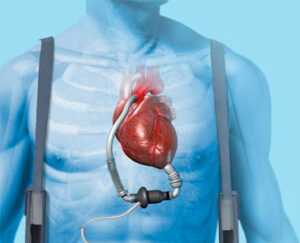 Top cardiologist in Bandra West Mumbai India Dubai, Heart Disease ...
